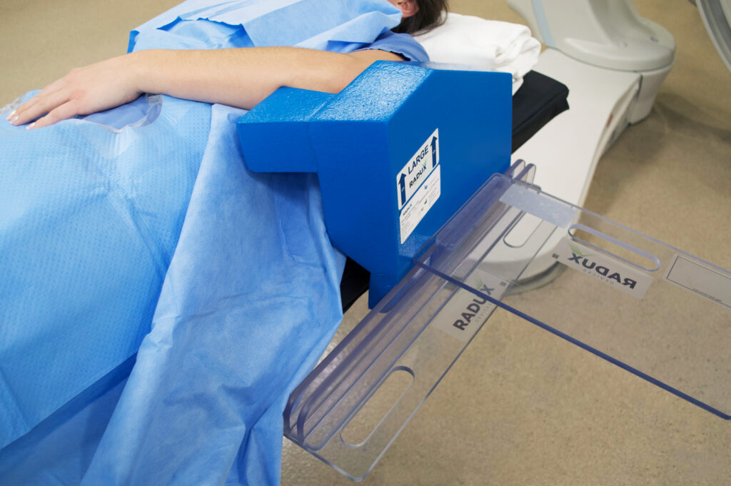 Left Radial System - Radux Devices