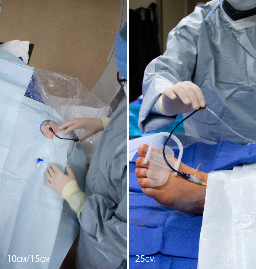 Instructions For Use - Radux Devices