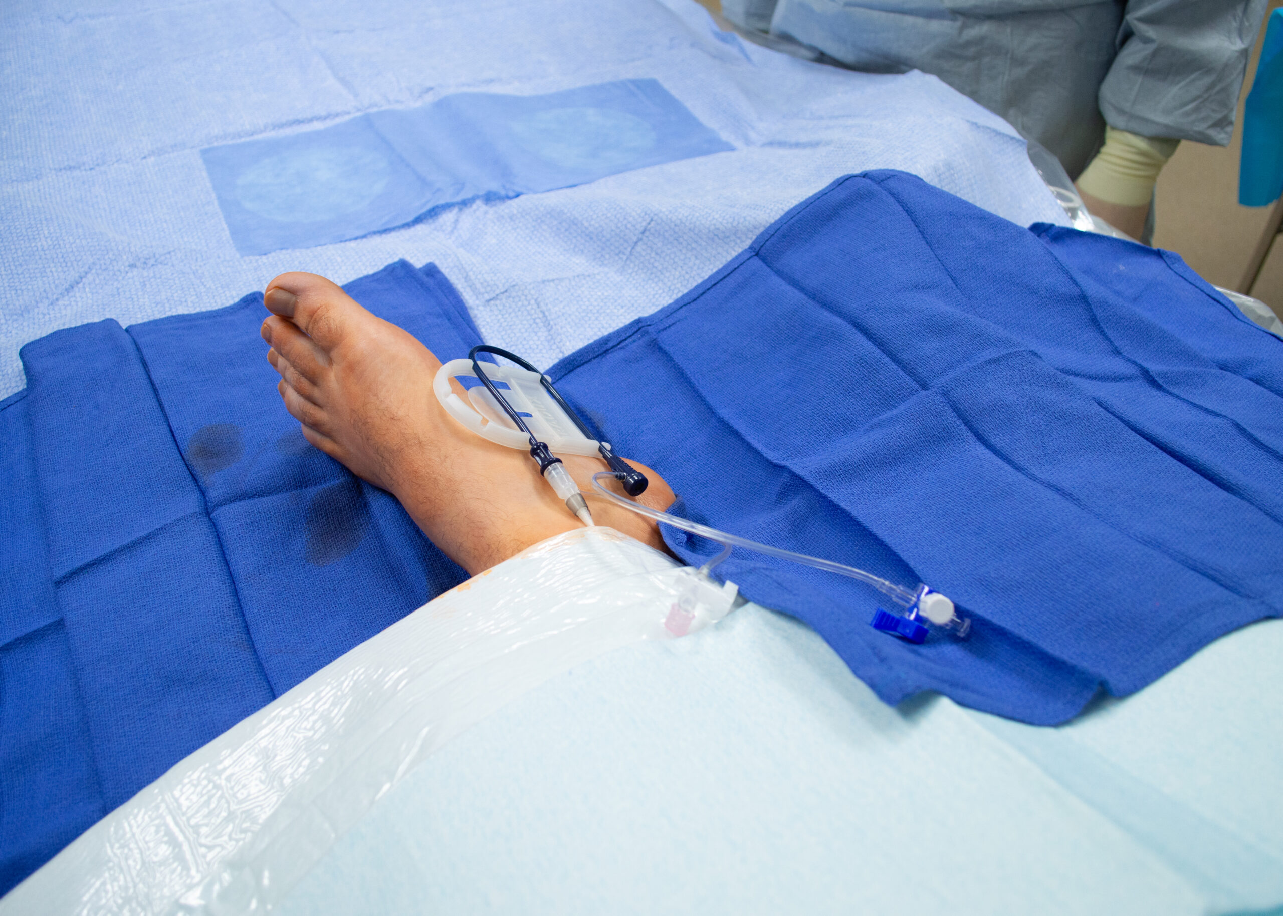 Radux StandTall™ Device for Vascular Access Management